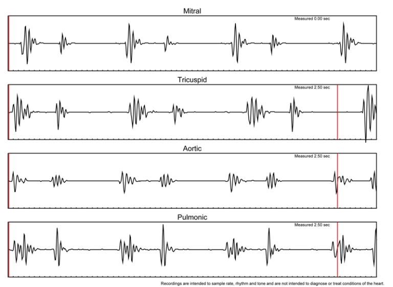 Heart Sound Recorder Testing Fair Oaks CA | (916) 965-8171